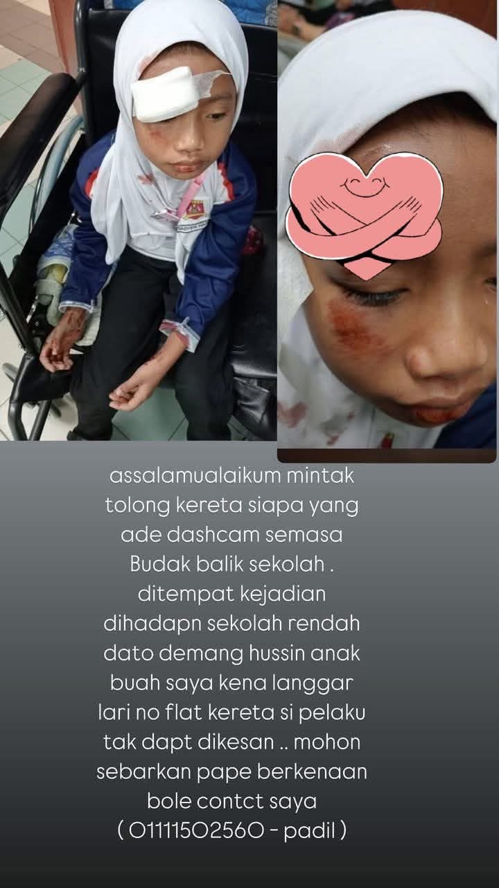 Dahi Berlubang, Cedera Di Muka, Mata Akibat Dilanggar Lari | The Rakyat ...